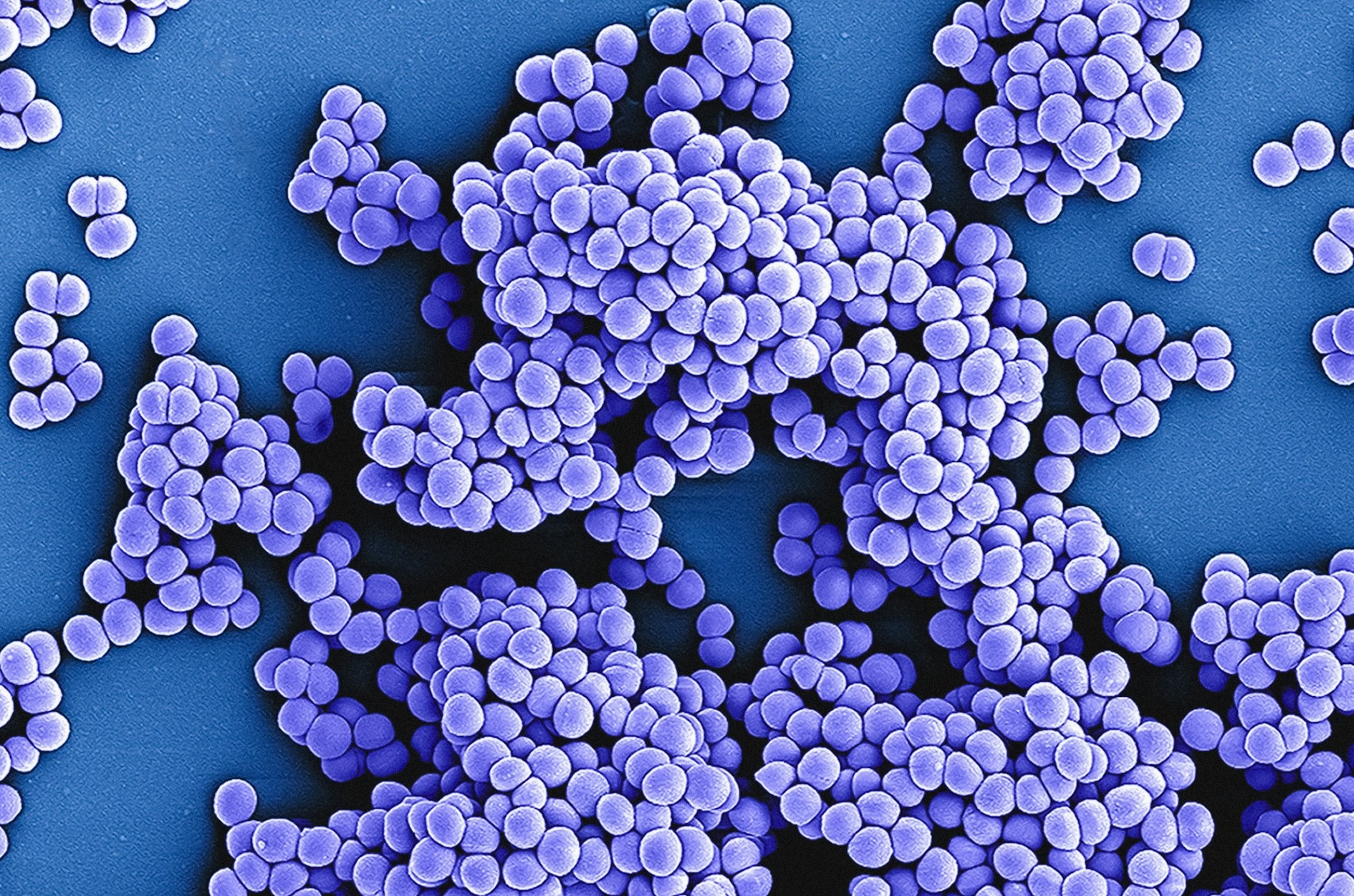 Bakteria zorzy polarnej vs. ludzki organizm. Czy to przeciwnik ...